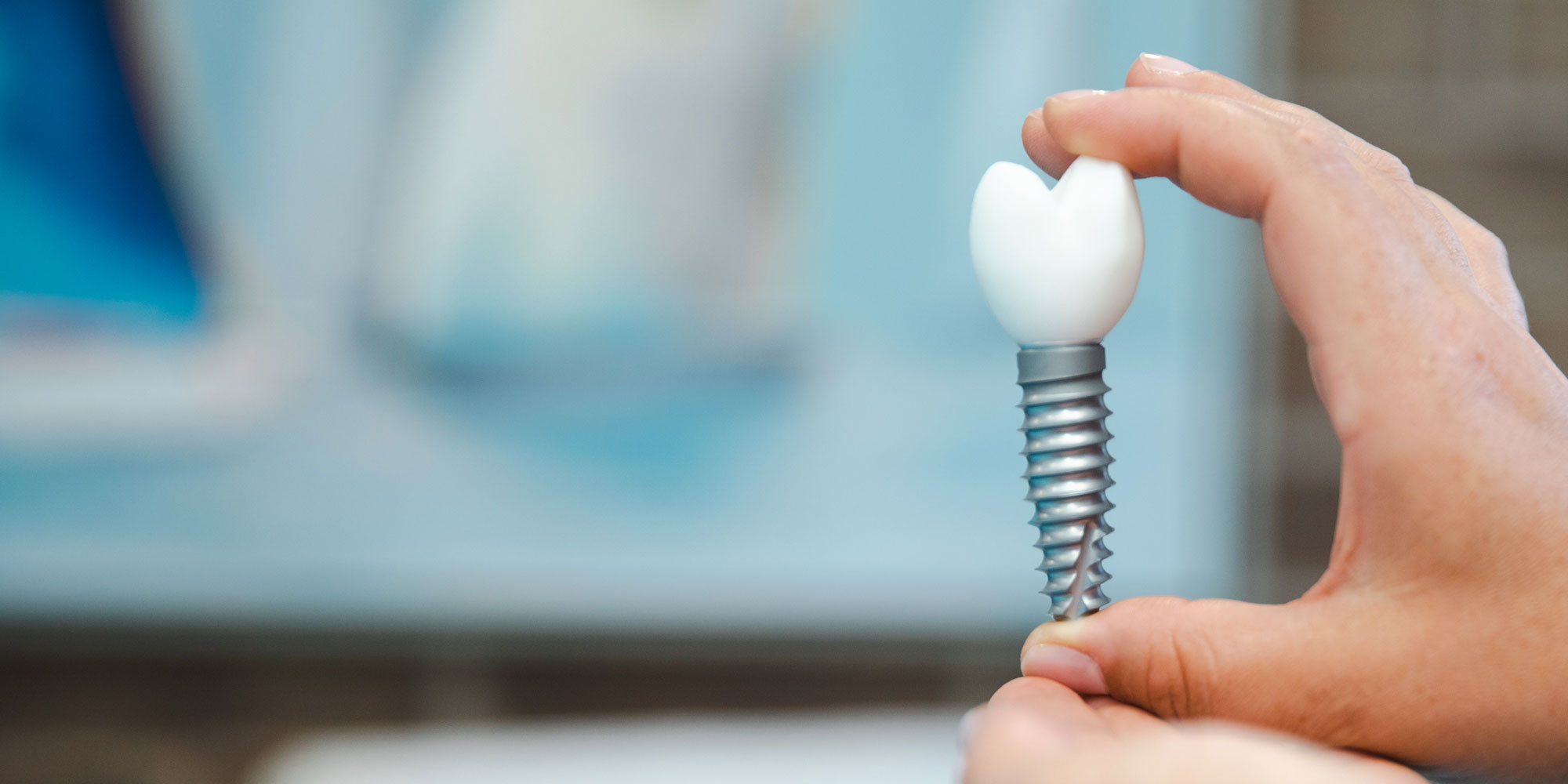 Dental Implants in Cape Coral, FL | Implant Dentistry